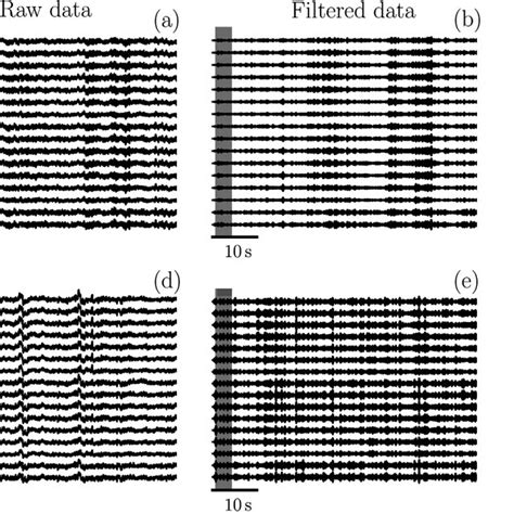 Examples Of Eeg Signals Analyzed In This Work Representation Of The