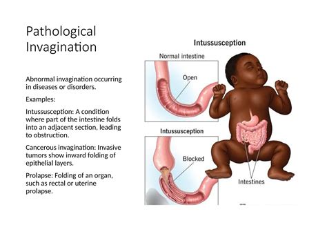 Anatomical Directions Invagination And Evagination Pptx