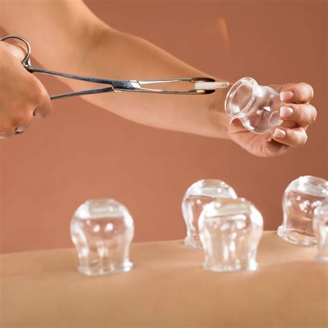 Cupping Therapy Wallpapers Wallpaper Cave