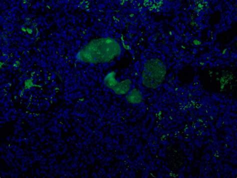 Anti Complement Component C9 Human Bioporto