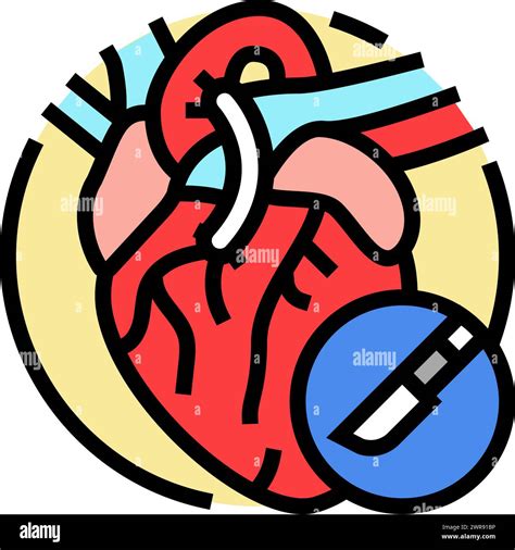 Bypass Surgery Stock Vector Images Alamy