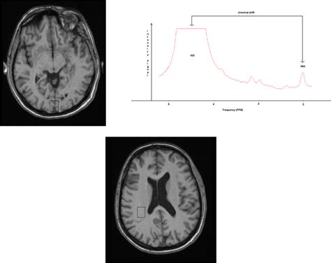 Visual Cortex Spectrum And Brain Temperature Measurement Voxel Of Download Scientific Diagram