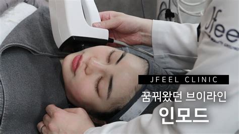 인모드 비수술 리프팅으로 꿈꿔왔던 브이라인만들기 Youtube