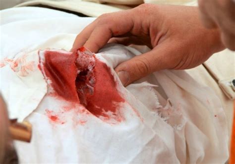 How To Treat A Gunshot Wound Types Of Gunshot Wounds NSFW