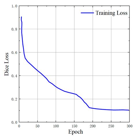 Rail Strans A Rail Surface Defect Segmentation Method Based On Improved Swin Transformer