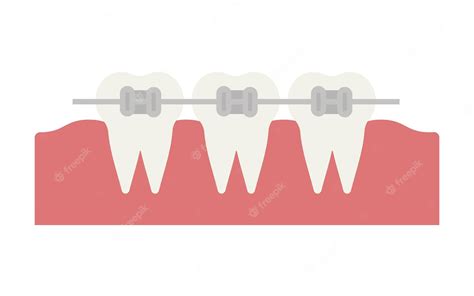 Premium Vector Metal Braces Dental Orthodontic Teeth With Braces