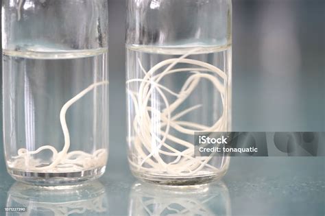 Ascariasis Adalah Penyakit Yang Disebabkan Oleh Cacing Gelang Parasit Dalam Larutan Fixatif