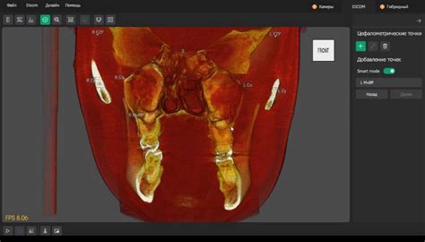 3d Viewer Дентомо ИИ