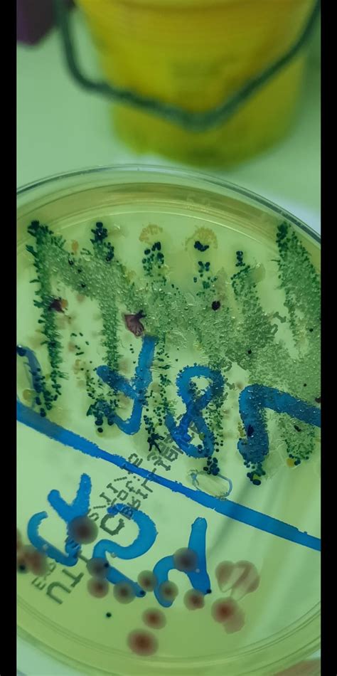 Pseudomonas Aeruginosa Is A Common Encapsulated Gram Negative Aerobic Facultatively Anaerobic