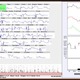 Web Based Visualization Interface Which Allows Users To Listen To