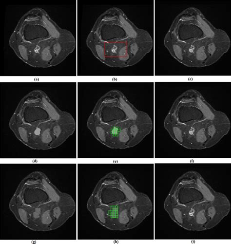 tamper localization and recovery a original image b selected roi c download scientific