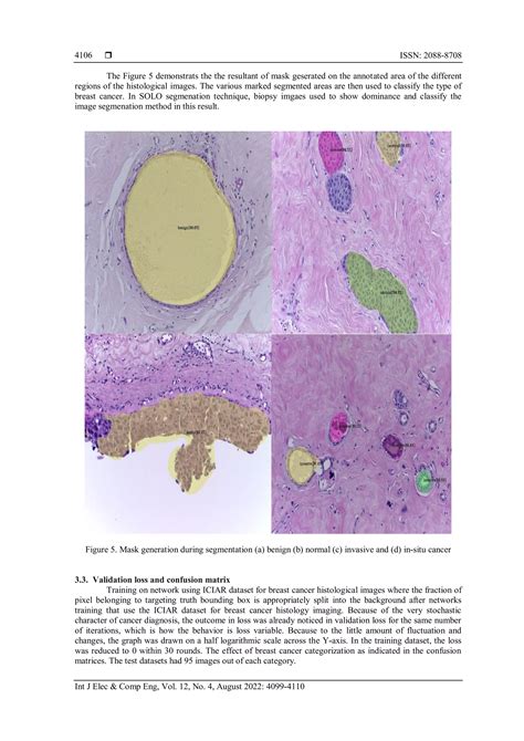 Breast Cancer Histological Images Nuclei Segmentation And Optimized Classification With Deep