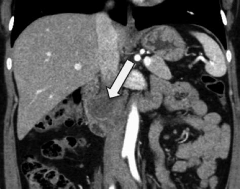 Jcpsp Journal Of College Of Physicians And Surgeons Pakistan