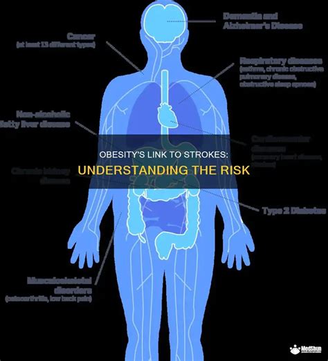 Obesitys Link To Strokes Understanding The Risk Medshun