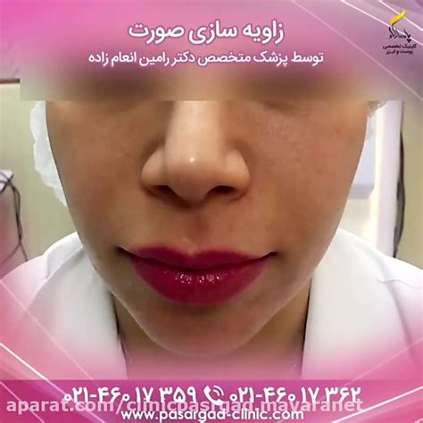 زاویه سازی صورت