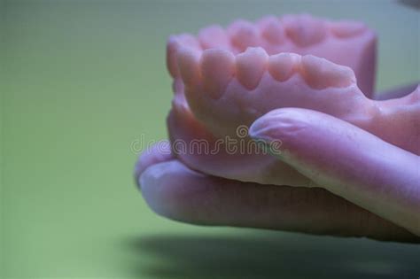 A Close Up Of Hands Gently Holding A Detailed Dental Mold With Visible