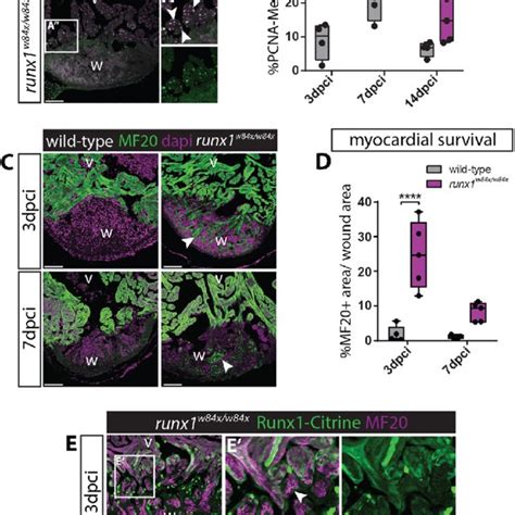 Increased Myocardial Proliferation And Protection In The Runx1 Mutant