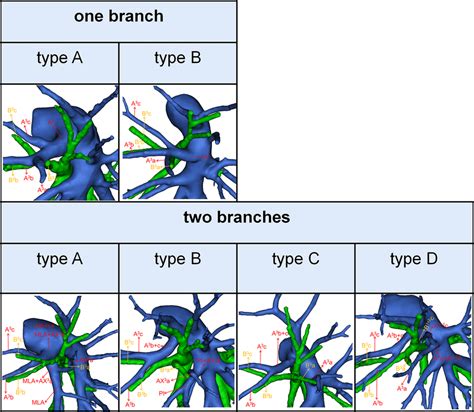 3d Reconstruction Model Of Branching Patterns Of The A³ Download