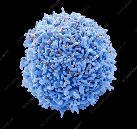 T Cell Infected With Hiv Sem Stock Image C038 6633 Science Photo