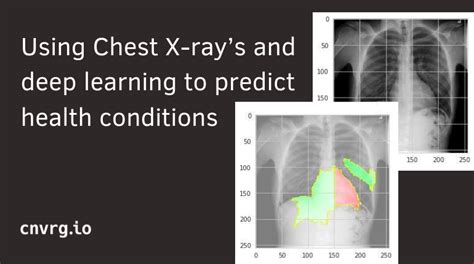 Using Chest X Rays And Deep Learning To Predict Health Conditions