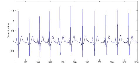 Figure 1 From Fpga Based Implementation Of A Multiplier Less Fir Filter