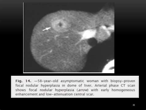 liver ppt pptx liver computed tomography pptx