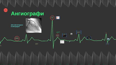 Ангиографи By Үсаги Цацаа On Prezi
