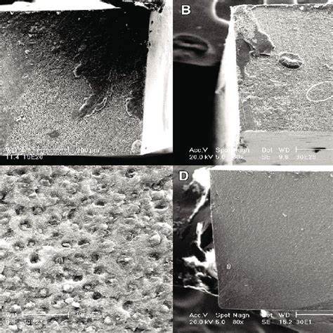 Schematic Representation Of The Preparation Of Resin Composite Dentin Download Scientific