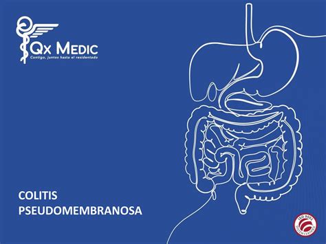 Ft GastroenterologÍa 3 Diarrea Crónica Colitis Pseudomembranosa Pdf