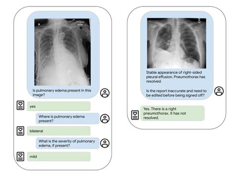 Dr Ashish Bamania On Linkedin Zero Shot Machine Learning Models Are Getting Popular Read