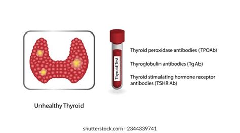 Thyroid Peroxidase