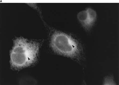 Immunofluorescence Localization Of Ers 24 In Cho Cells Indirect Download Scientific Diagram