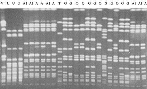 Example Of Pfge Profiles Of Smai Macrorestriction Fragments Of