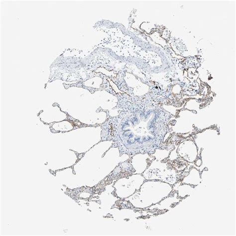 Tissue Expression Of Pdpn Staining In Lung The Human Protein Atlas