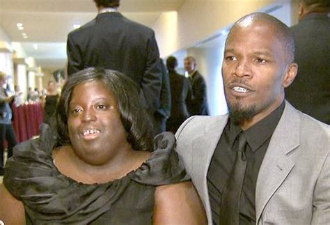 23 Celebrities And Public Figures Who Love Someone With Down Syndrome