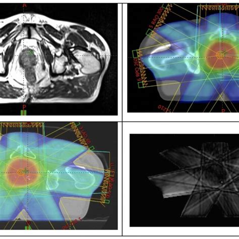 example of a patient top left large field of view mri scan download scientific diagram