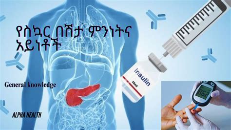 ጠቅላላ እዉቀት የስኳር በሽታ ምንነትና አይነቶች Youtube