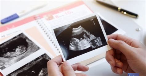 정부 임신중지 약물 합법화 추진 산부인과는 ‘여성의학과로 명칭 변경