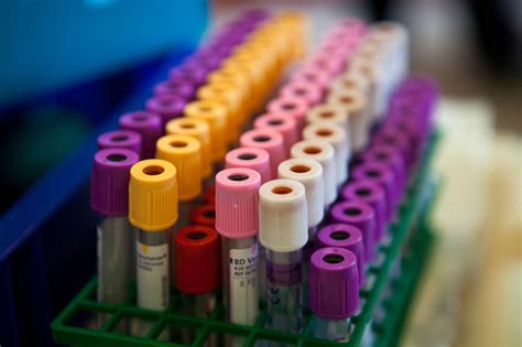 Ctdna Test Could Help Guide Treatment For Advanced Gist