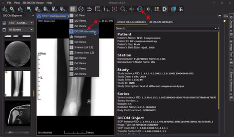 Dicom Attributes Weasis Documentation