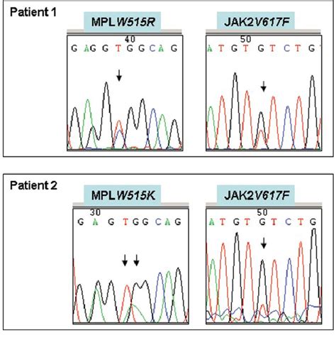 dna sequence traces showing concurrent presence of jak2v617f and mpl