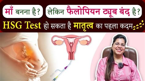 What Is Hysterosalpingogram Test Hsg Test Procedure Recovery
