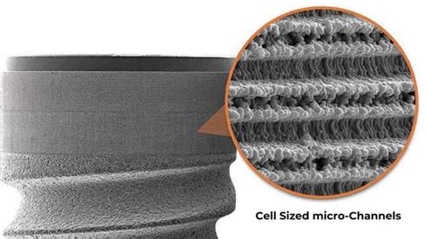 Biohorizons Implant System Overview Pptx Technology And Computing