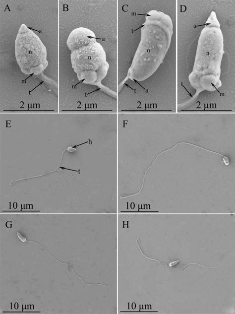 Scanning Electron Micrographs Of The Sperm Of Four Species Shellfish
