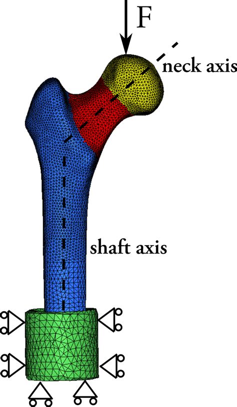 5 Fe Models Of A Composite Bone Transversely Isotropic Material Download Scientific Diagram