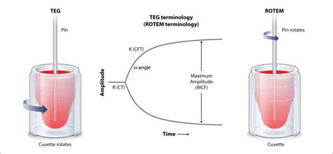 Background And Evaluation Of Hypercoagulability Pmc