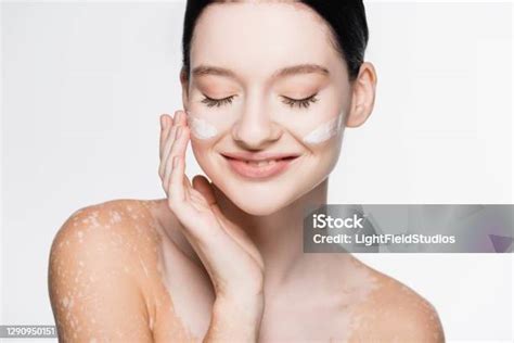 흰색에 고립 된 뺨에 Vitiligo와 얼굴 크림을 가진 젊은 아름다운 여자 미소 백반증에 대한 스톡 사진 및 기타 이미지 백반증 얼굴 크림 한 명의 여자만 Istock