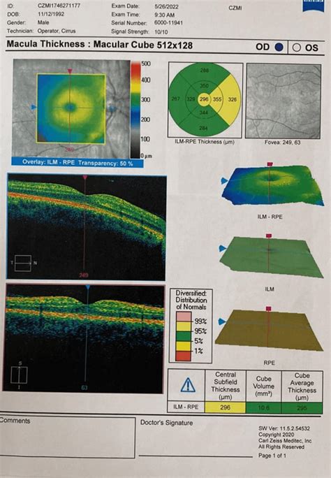 Is This Considered Pathological Myopia Rmyopia