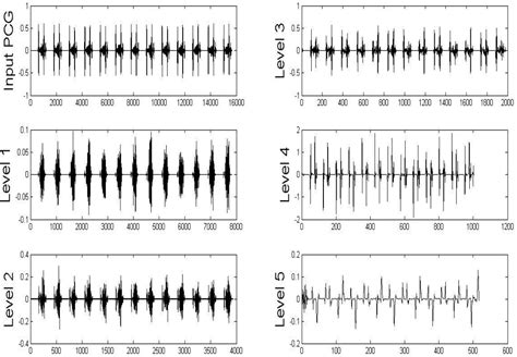 Figure 5 4 From Statistical Signal Processing Approach To Segment Primary Components From