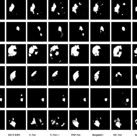 Qualitative Performance Of The Segmentation Models For Various Types Of